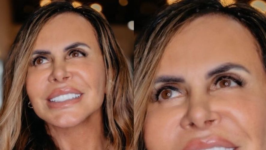 MidiaNews | Aos 62 anos, Gretchen celebra novo procedimento estético