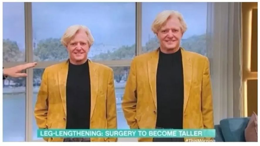 MidiaNews | Nos EUA, homem gasta mais de R$ 800 mil para fazer cirurgia