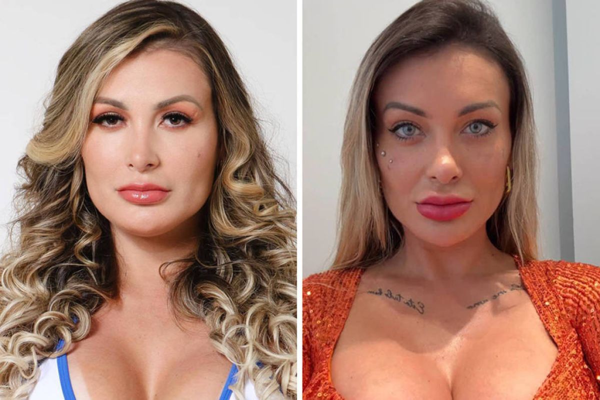 MidiaNews | Urach relata arrependimento após cirurgia para mudar cor dos olhos